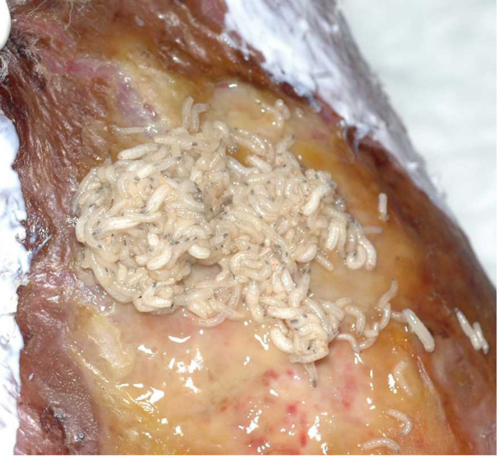 Topic One: Larval Therapy | ActivHeal® Academy